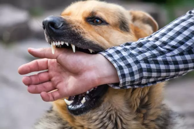 Bisakah Saya Dituntut jika Anjing Saya Menggigit Pelanggar? 155_1